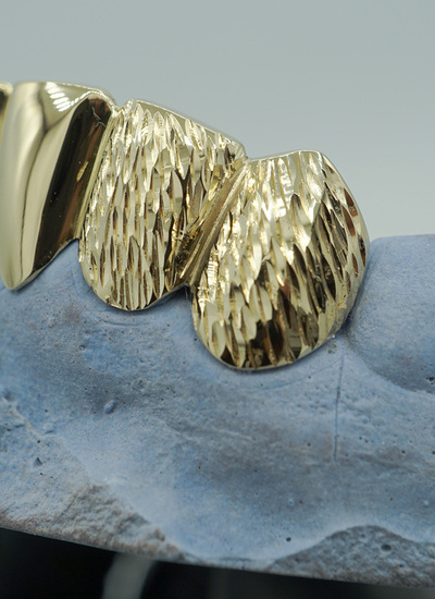 Een maatwerk 14k of 18k geelgouden tand laten maken? - Twenty20Jewelry
