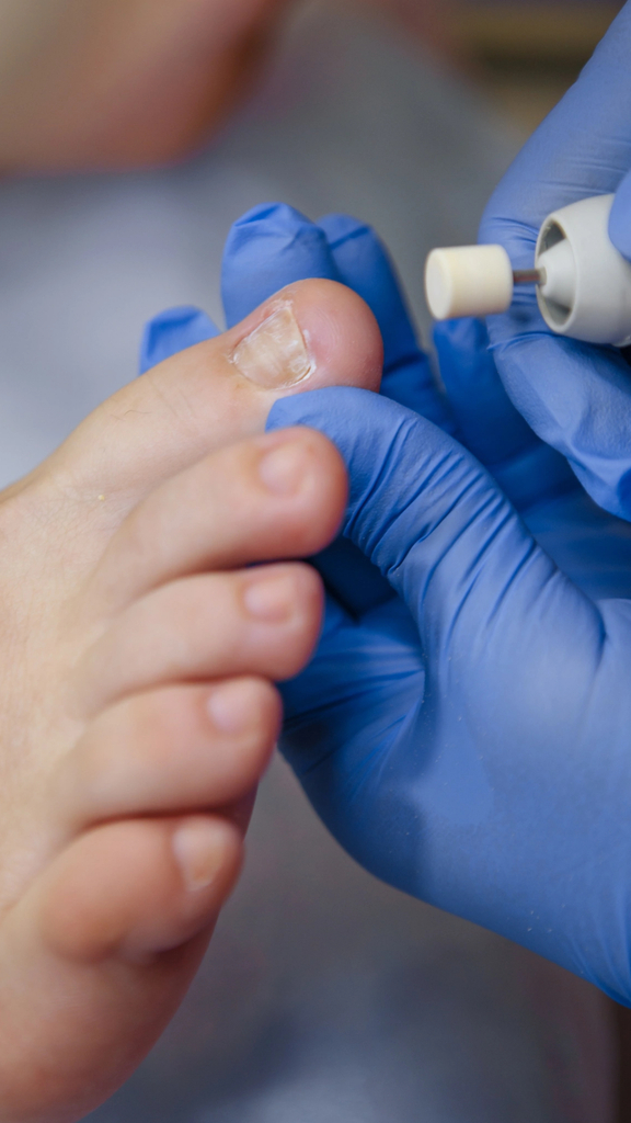 Podiatry Croydon - Step Into Healthier Feet Today!