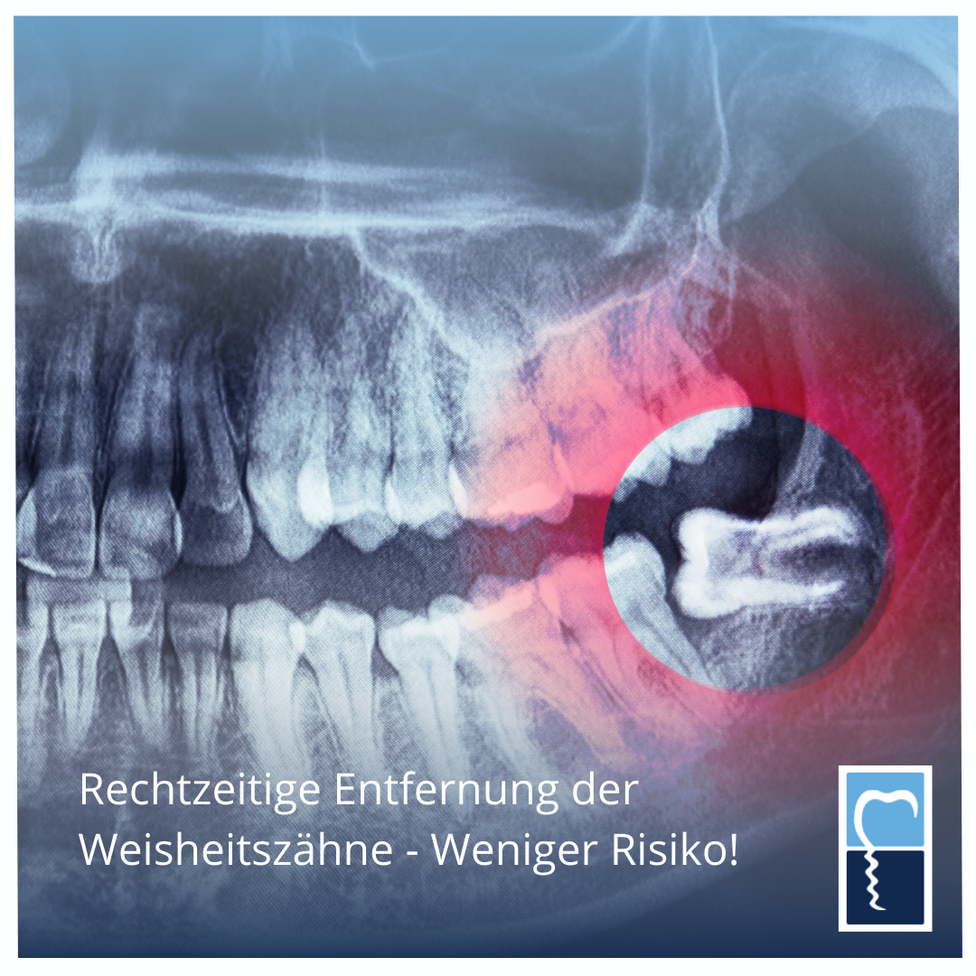 Zahnfleischtaschen erkennen, messen und behandeln in Lauf!